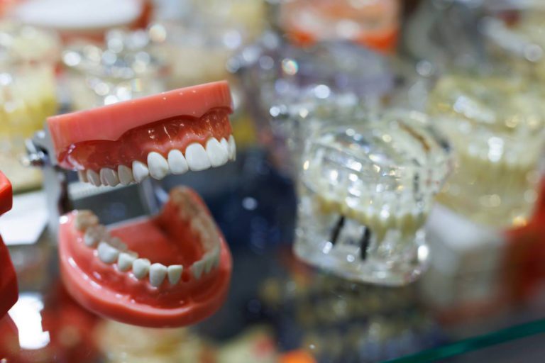 Guide to Storing Dentures - Valley Alder Family Dentistry - Blog